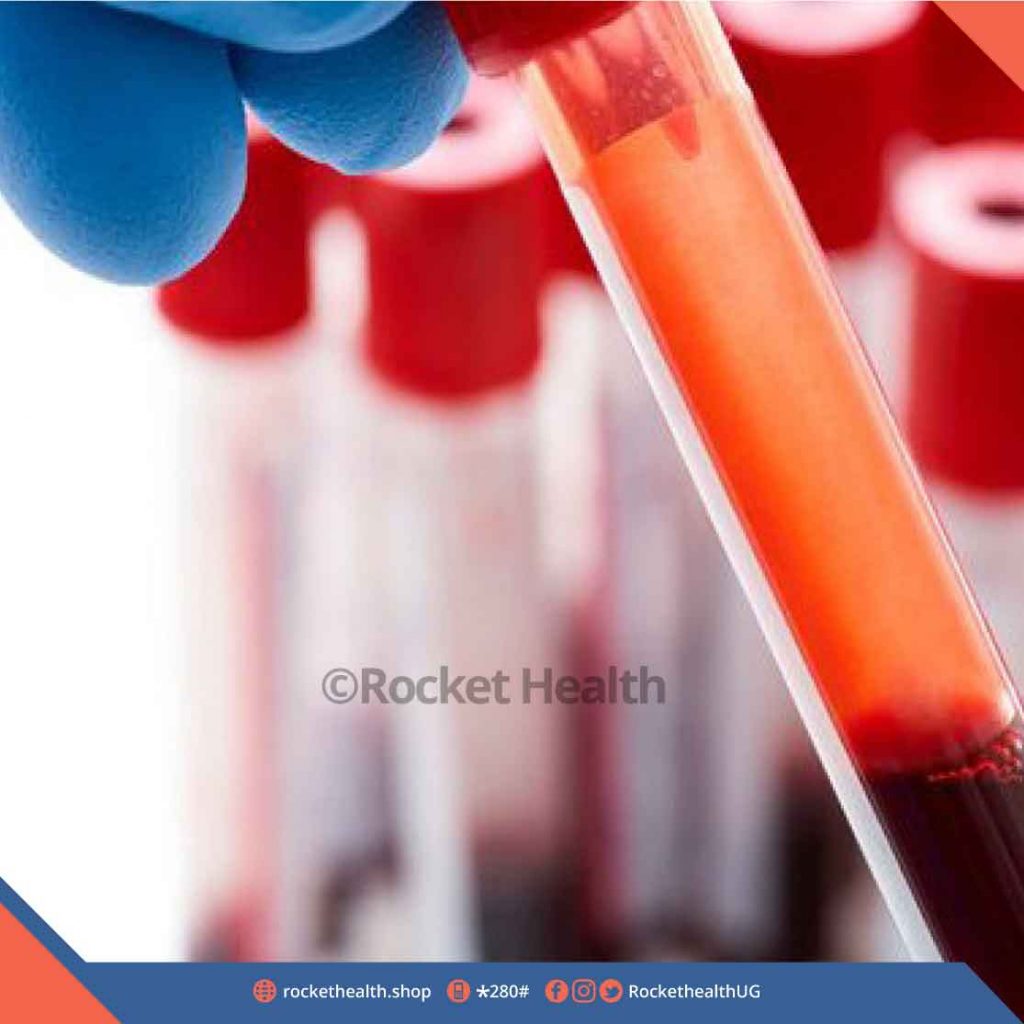 PROSTATE SPECIFIC ANTIGEN (SCREENING) | Rocket Health Shop