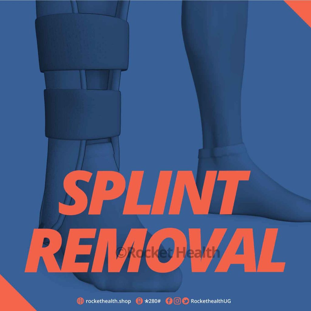 Splint Removal | Rocket Health Shop